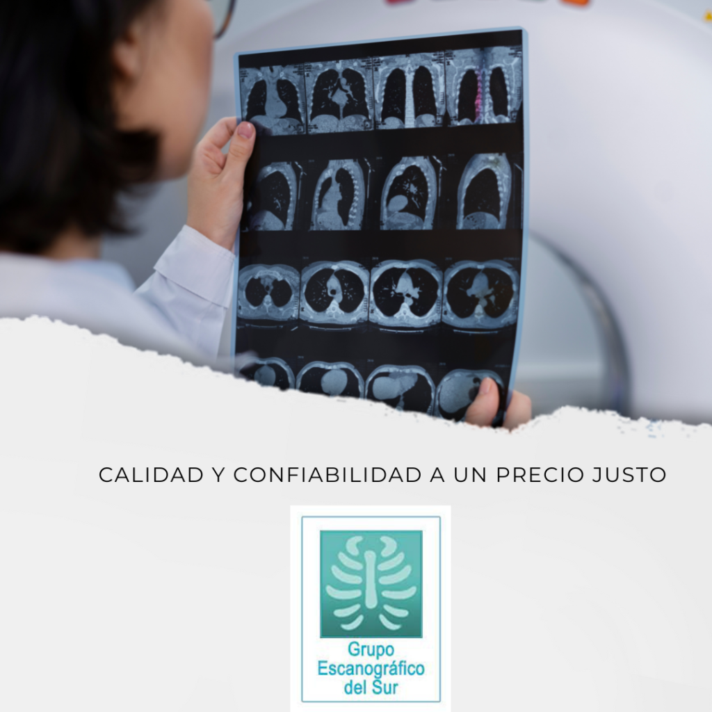 Grupo Escanográfico Del Sur – Tarjeta Gran Red